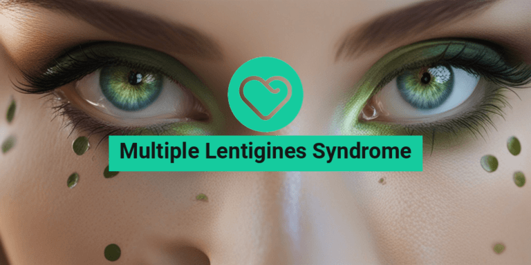 Multiple Lentigines Syndrome: Causes, Symptoms, and Treatment Options ...