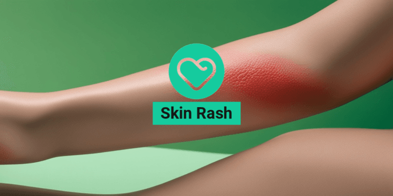 Skin Rash: Causes, Symptoms, and Treatment Options • Yesil Health AI