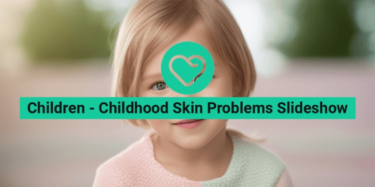 Children – Childhood Skin Problems Slideshow: Common Skin Issues in ...
