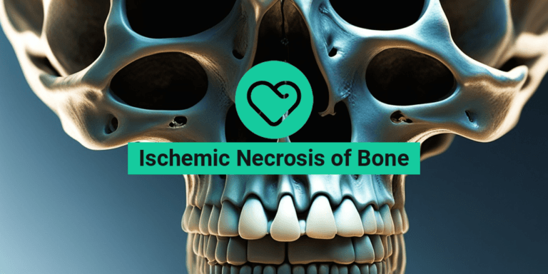 Ischemic Necrosis of Bone: Causes, Symptoms, and Treatment Options ...