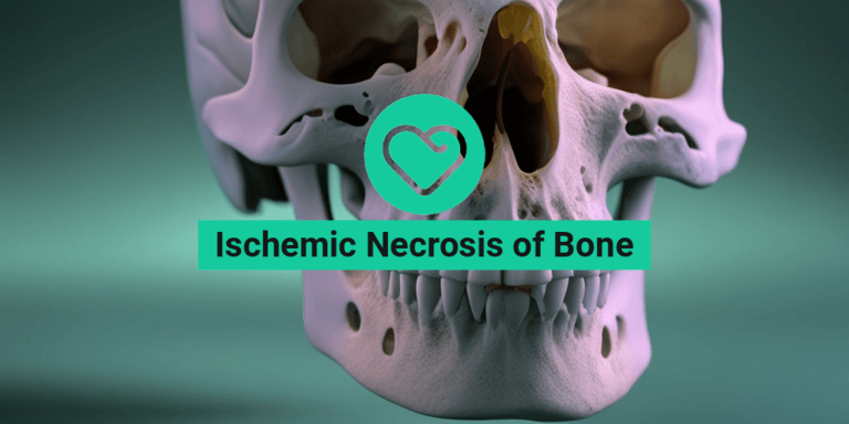 Ischemic Necrosis of Bone: Causes, Symptoms, and Treatment Options ...