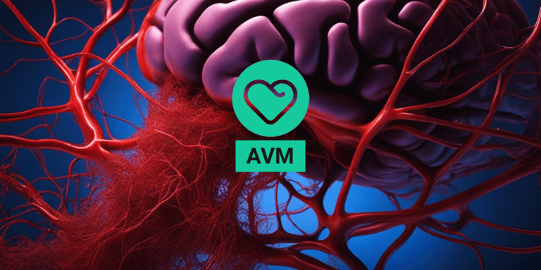AVM: Understanding Arteriovenous Malformations • Yesil Health