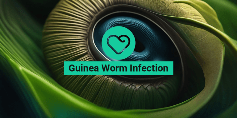 Guinea Worm Infection: Causes, Symptoms, and Treatment Options • Yesil ...