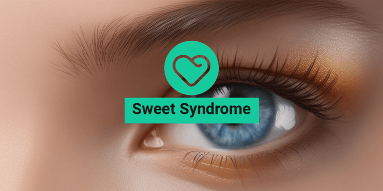 Sweet Syndrome: Causes, Symptoms, and Treatment Options • Yesil Health
