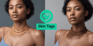 Skin Tags: Causes, Removal, and Prevention of Skin Growths • Yesil ...