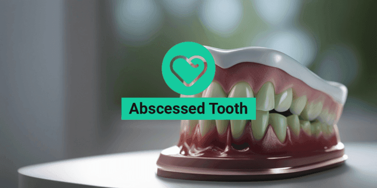 Abscessed Tooth: Symptoms, Causes, and Treatment Options • Yesil Health
