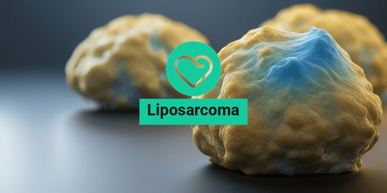 Liposarcoma: Causes, Symptoms, Diagnosis, and Treatment Options • Yesil Health