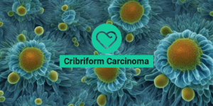 Cribriform Carcinoma: Symptoms, Diagnosis, and Treatment Options ...