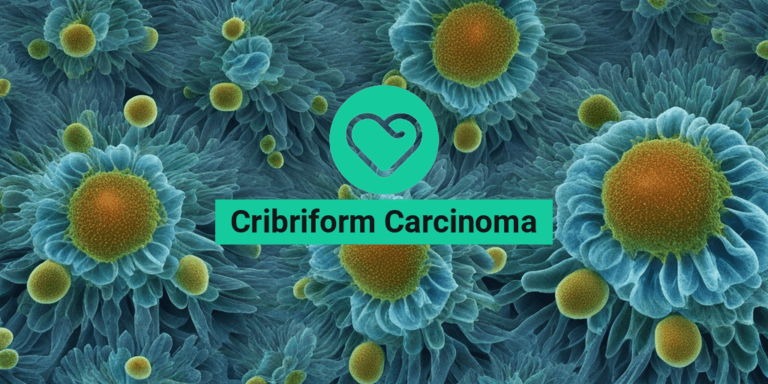 Cribriform Carcinoma: Symptoms, Diagnosis, and Treatment Options ...