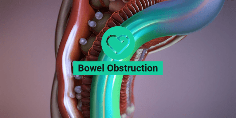 Bowel Obstruction: Causes, Symptoms, and Treatment Options • Yesil ...