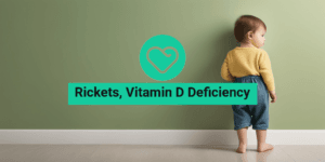 Rickets, Vitamin D Deficiency: Causes, Symptoms, and Treatment Options ...