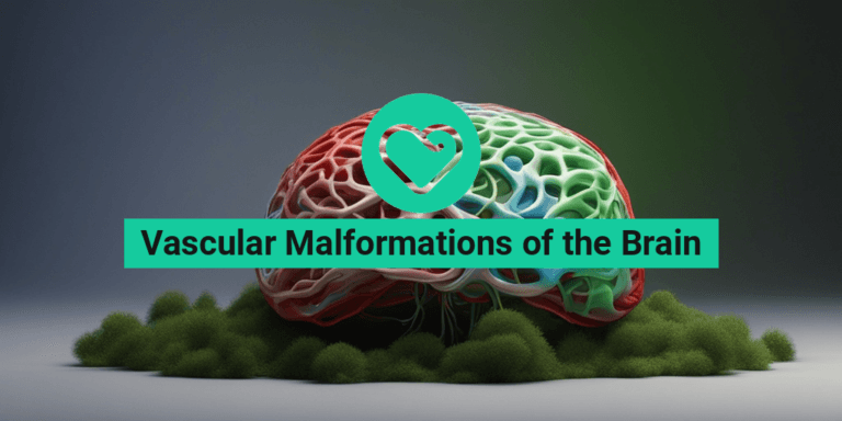 Vascular Malformations of the Brain: Causes, Symptoms, and Treatment Options • Yesil Health