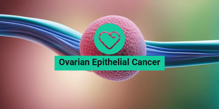 Ovarian Epithelial Cancer: Symptoms, Diagnosis, and Treatment Options ...