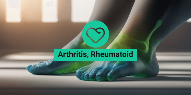 Arthritis, Rheumatoid: Symptoms, Causes, Diagnosis, and Treatment ...