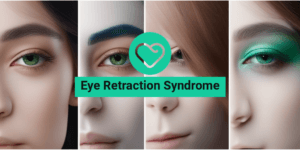 Eye Retraction Syndrome: Causes, Symptoms, and Treatment Options ...