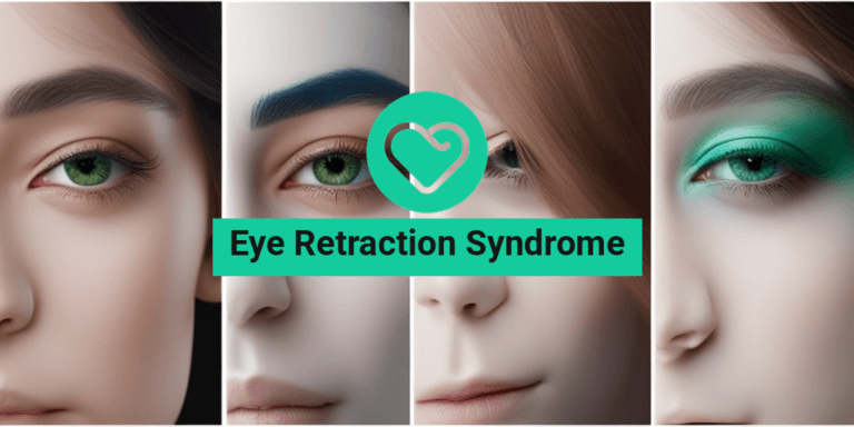 Eye Retraction Syndrome: Causes, Symptoms, and Treatment Options ...