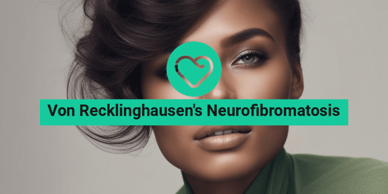 Von Recklinghausen’s Neurofibromatosis: Causes, Symptoms, and Treatment ...