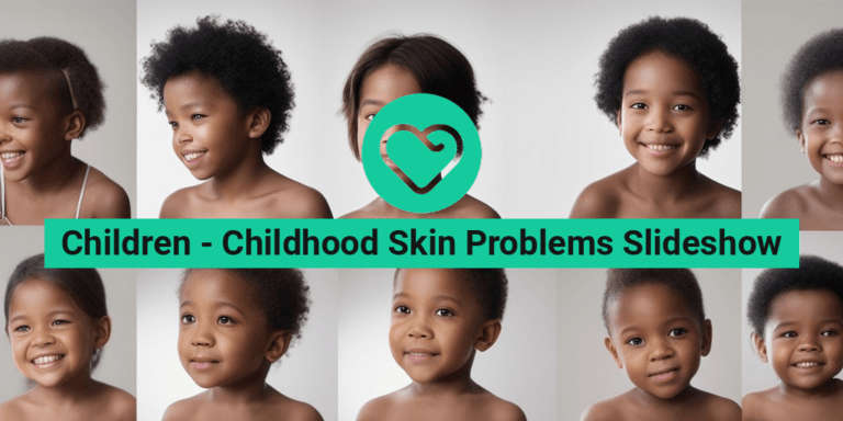 Children – Childhood Skin Problems Slideshow: Common Conditions and ...