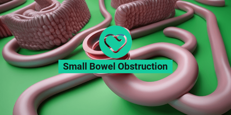 Small Bowel Obstruction: Causes, Symptoms, and Treatment Options ...