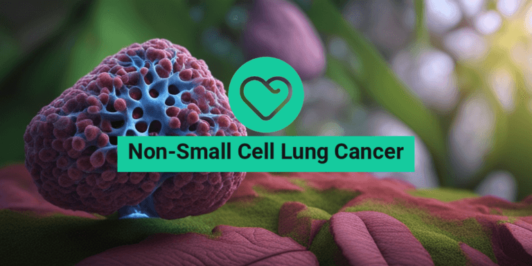 Non Small Cell Lung Cancer Symptoms Diagnosis And Treatment Options