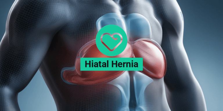 Hiatal Hernia: Symptoms, Causes, Diagnosis, and Treatment Options ...