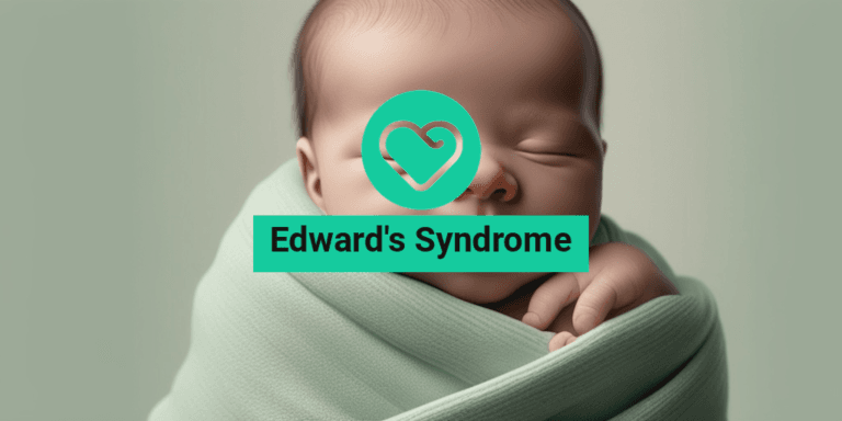 Edward’s Syndrome: Causes, Symptoms, Diagnosis, and Treatment • Yesil ...