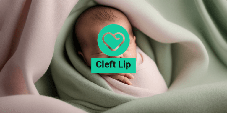 Cleft Lip and Palate: Causes, Symptoms, and Treatment Options • Yesil ...