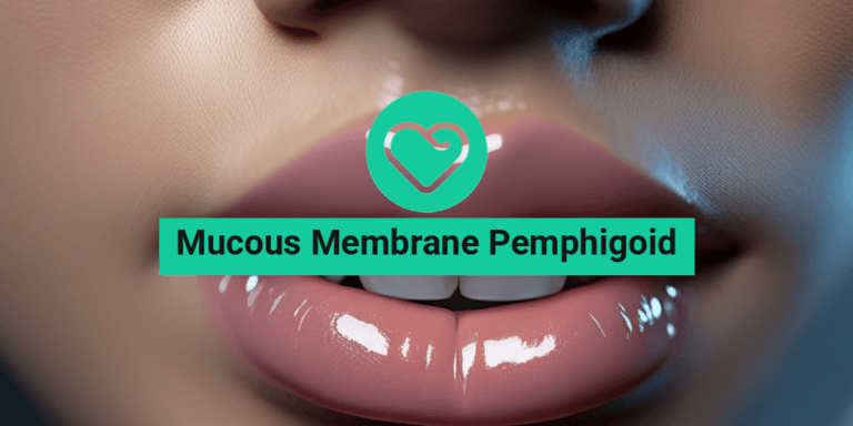 Mucous Membrane Pemphigoid: Causes, Symptoms, and Treatment Options ...