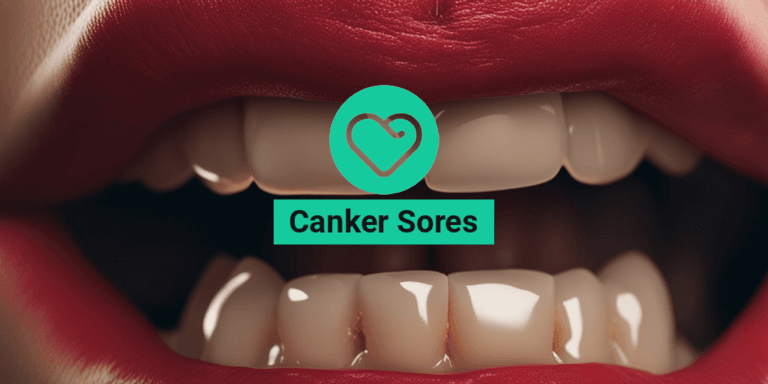Canker Sores: Causes, Symptoms, and Treatments • Yesil Health