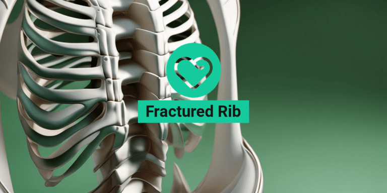 Fractured Rib: Symptoms, Causes, and Treatment Options • Yesil Health