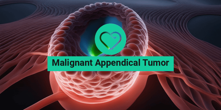 Malignant Appendical Tumor: Understanding Symptoms, Causes, and ...