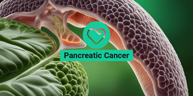 Pancreatic Cancer: Understanding Symptoms, Causes, and Treatments ...