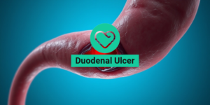 Duodenal Ulcer: Symptoms, Causes, and Treatment Options • Yesil Health AI