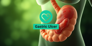 Gastric Ulcer: Understanding Symptoms, Causes, and Treatments • Yesil ...