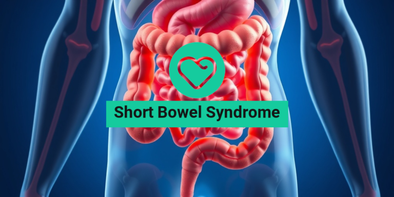 Short Bowel Syndrome: Understanding Causes, Symptoms, and Management ...