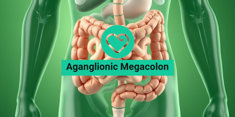 Aganglionic Megacolon: Understanding Symptoms, Causes, and Treatments ...