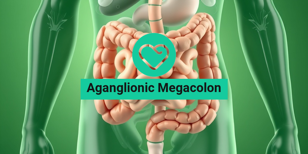 Aganglionic Megacolon: Understanding Symptoms, Causes, and Treatments ...