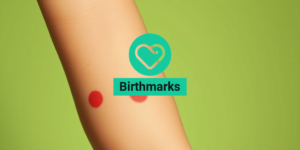 Birthmarks: Understanding Types, Causes, and Treatments • Yesil Health AI