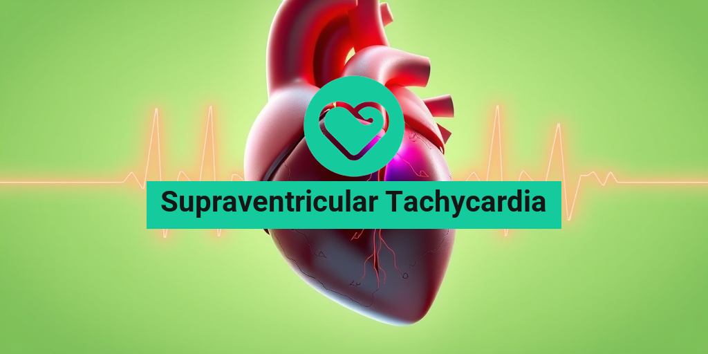 Supraventricular Tachycardia: Understanding Symptoms, Causes, and ...